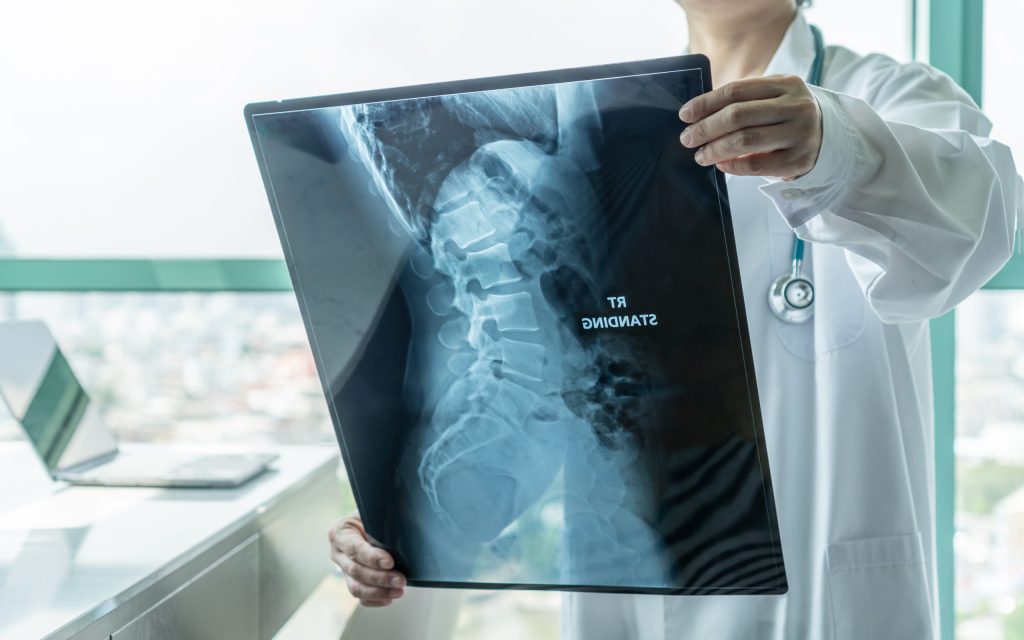 Spondilolistezis - Afectiuni si conditii - clinica Neuroaxis